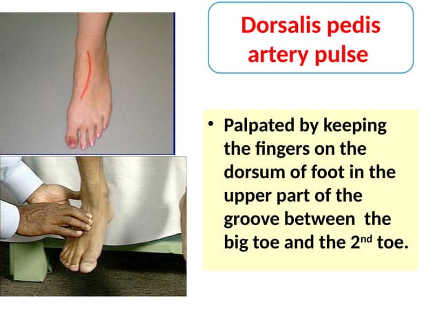 Examination of arterial and venous pulse copy.pptx