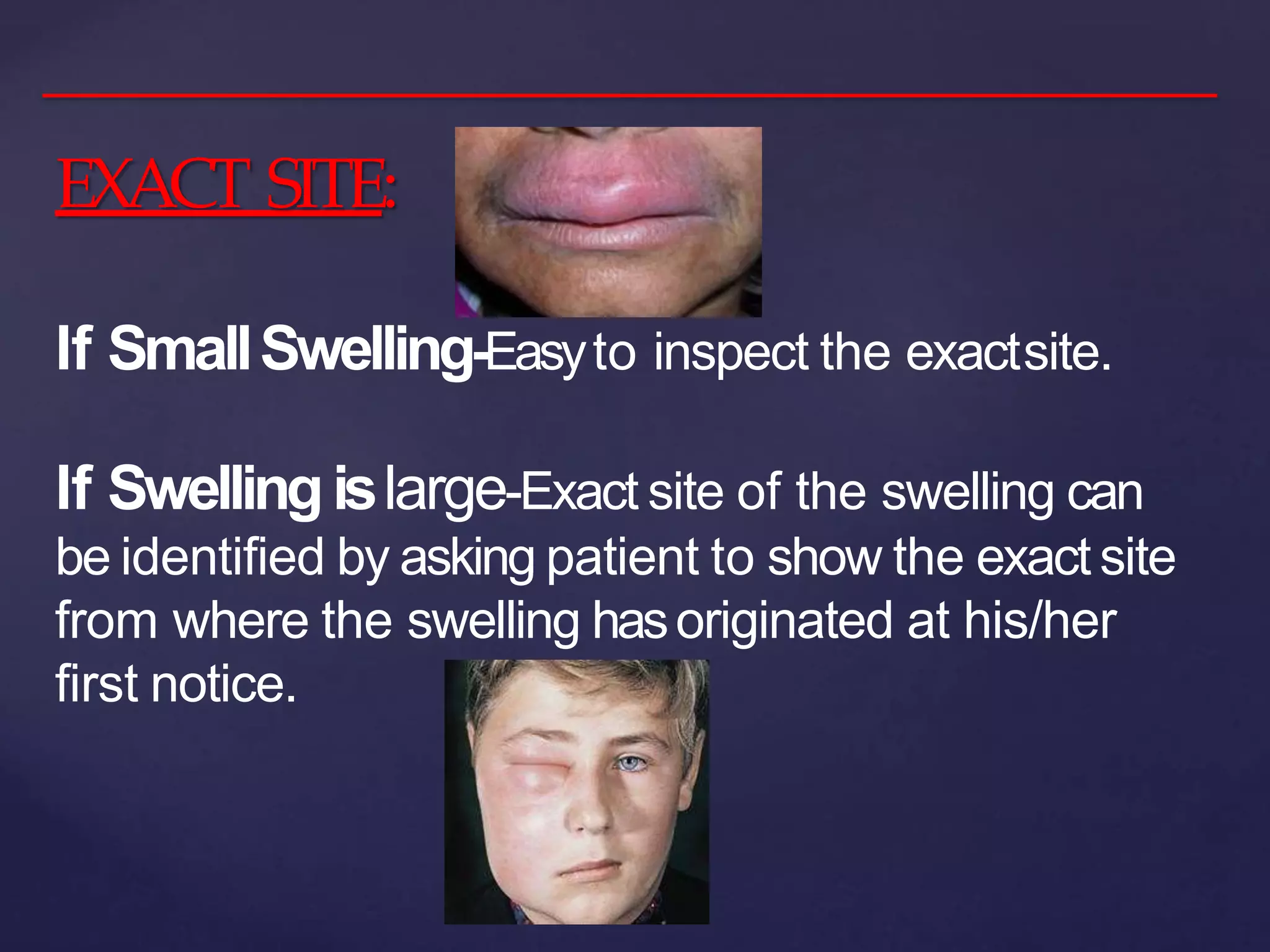 Examination of a swelling | PPTX