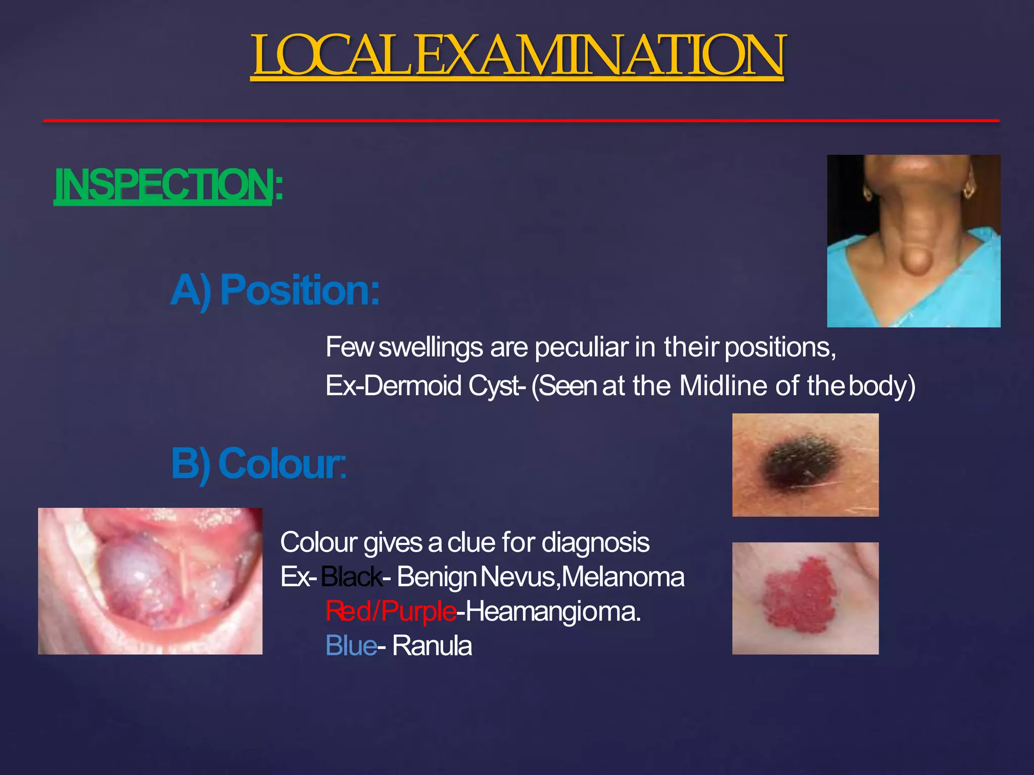 Examination of a swelling | PPTX