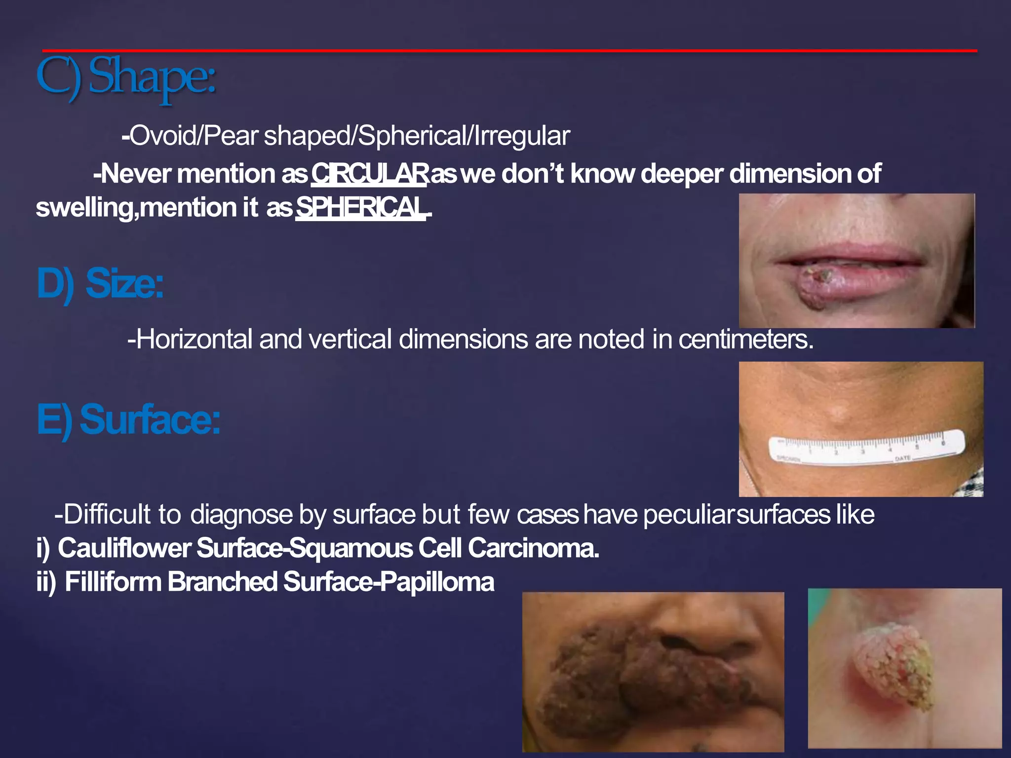 Examination of a swelling | PPTX