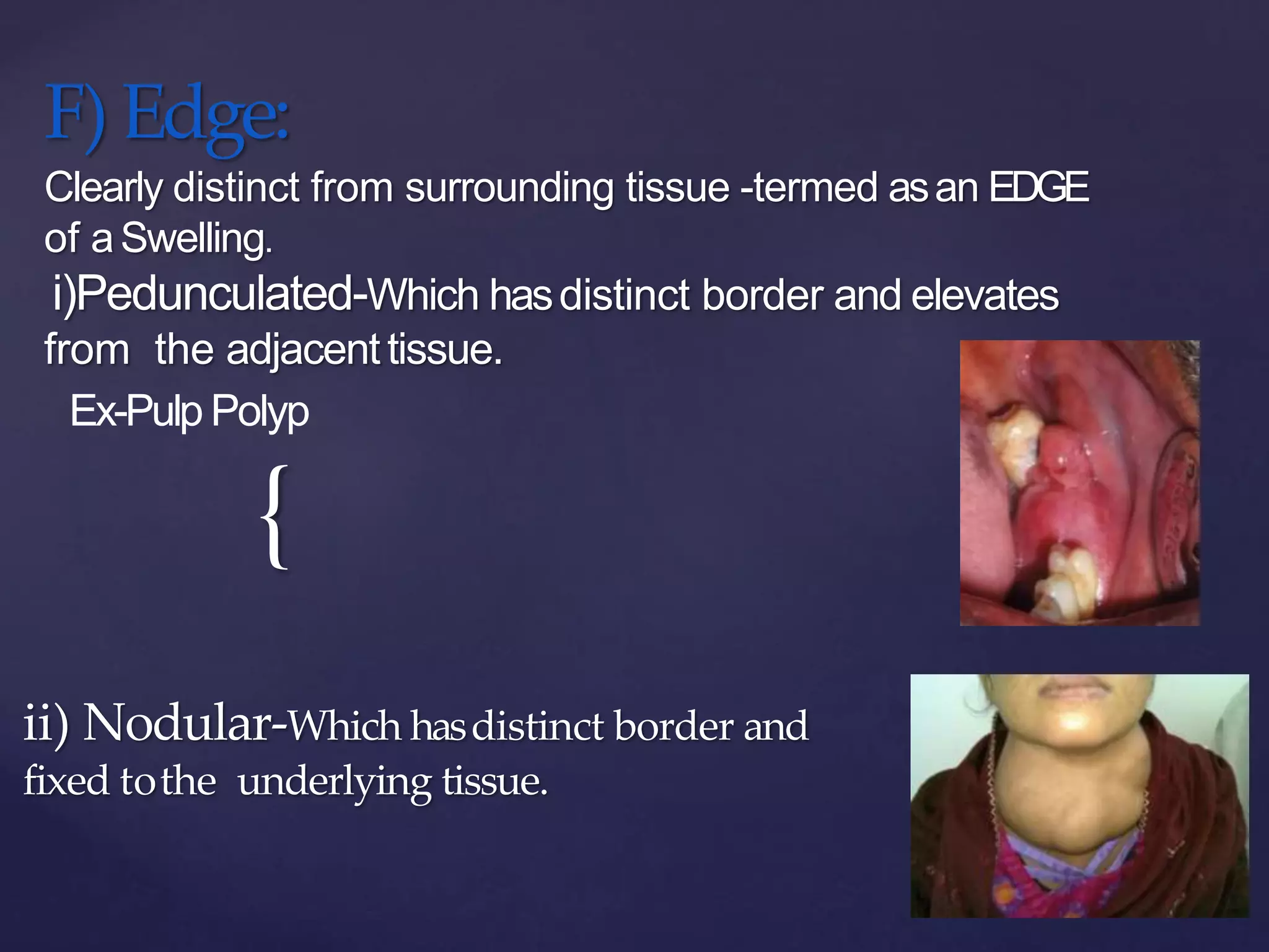 Examination of a swelling | PPTX