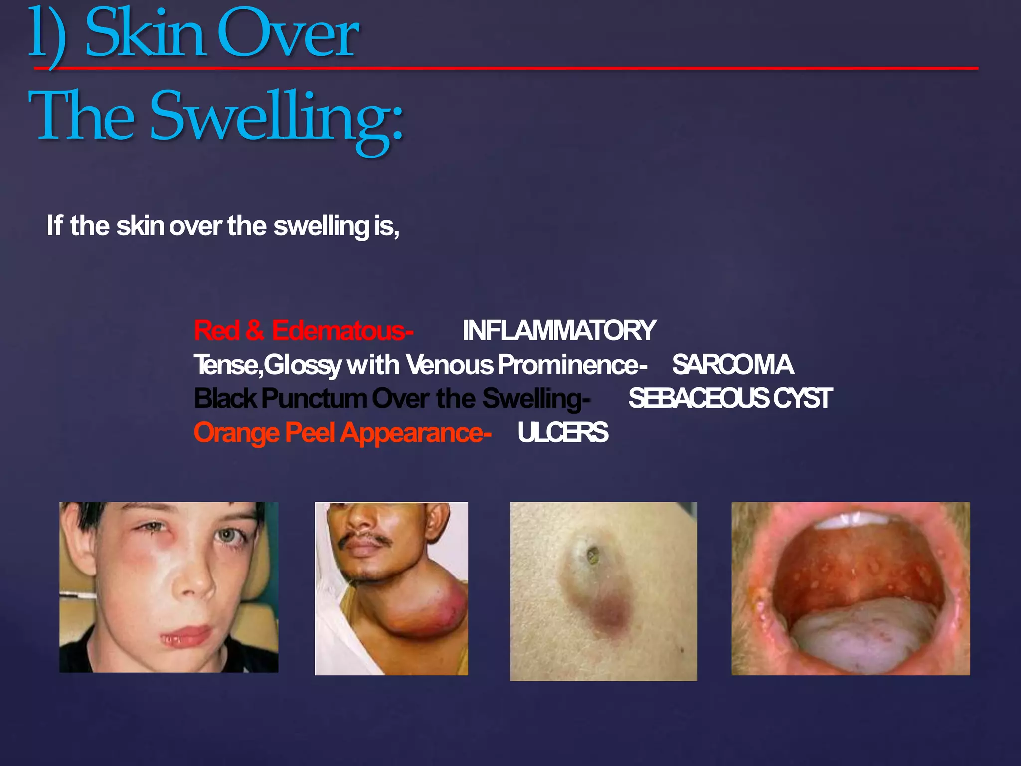 Examination of a swelling | PPTX