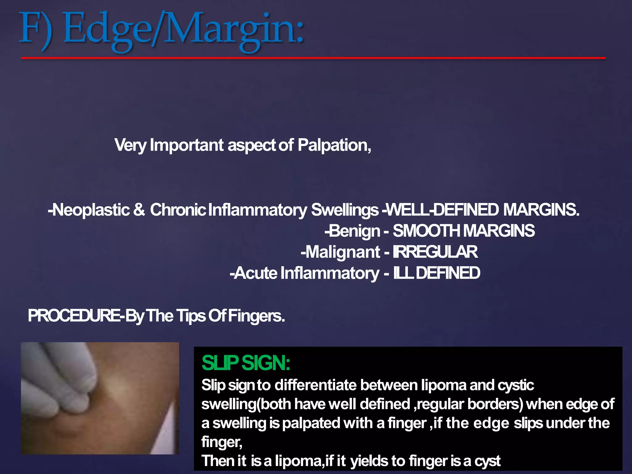 Examination of a swelling | PPTX
