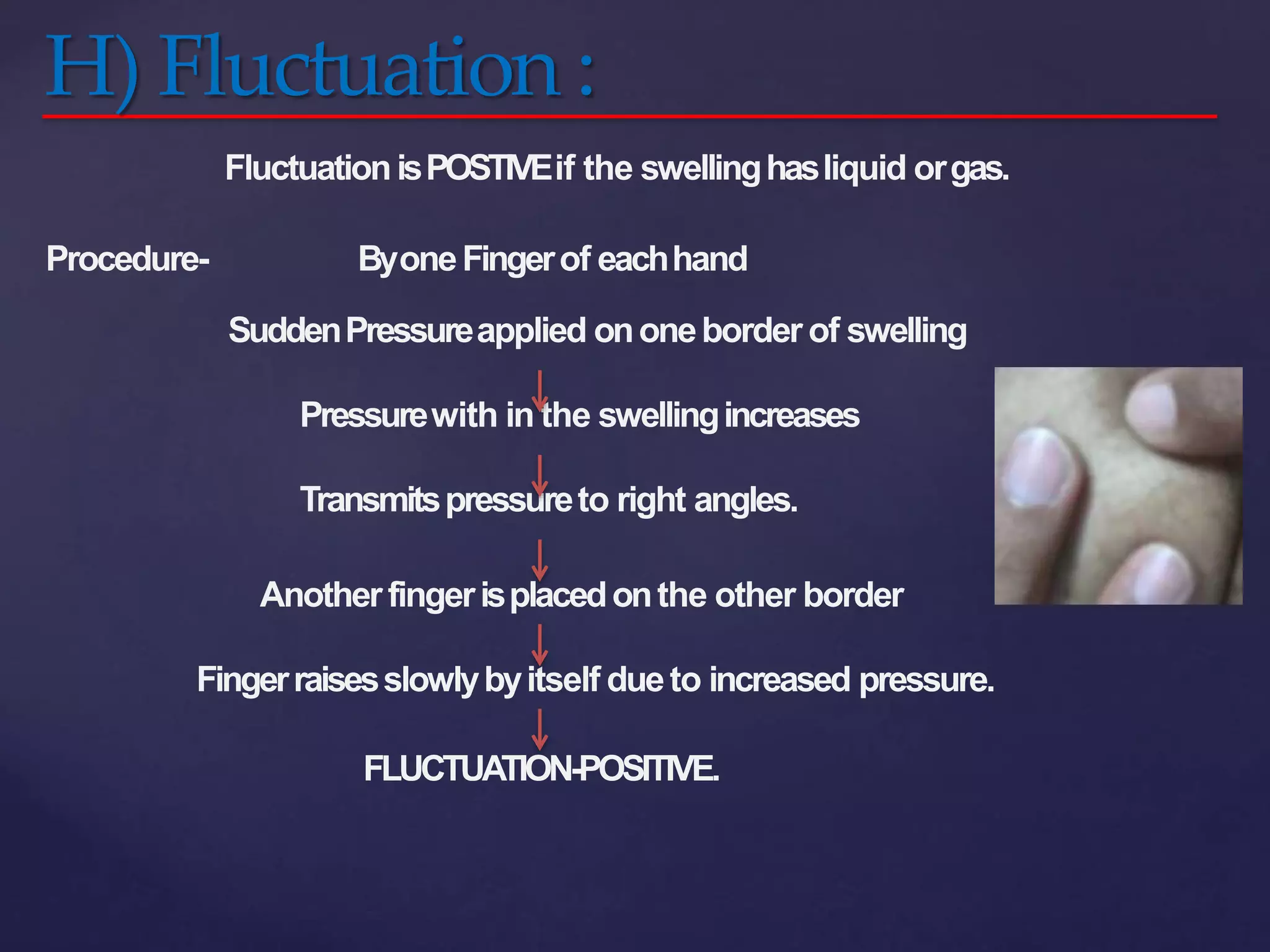 Examination of a swelling | PPTX