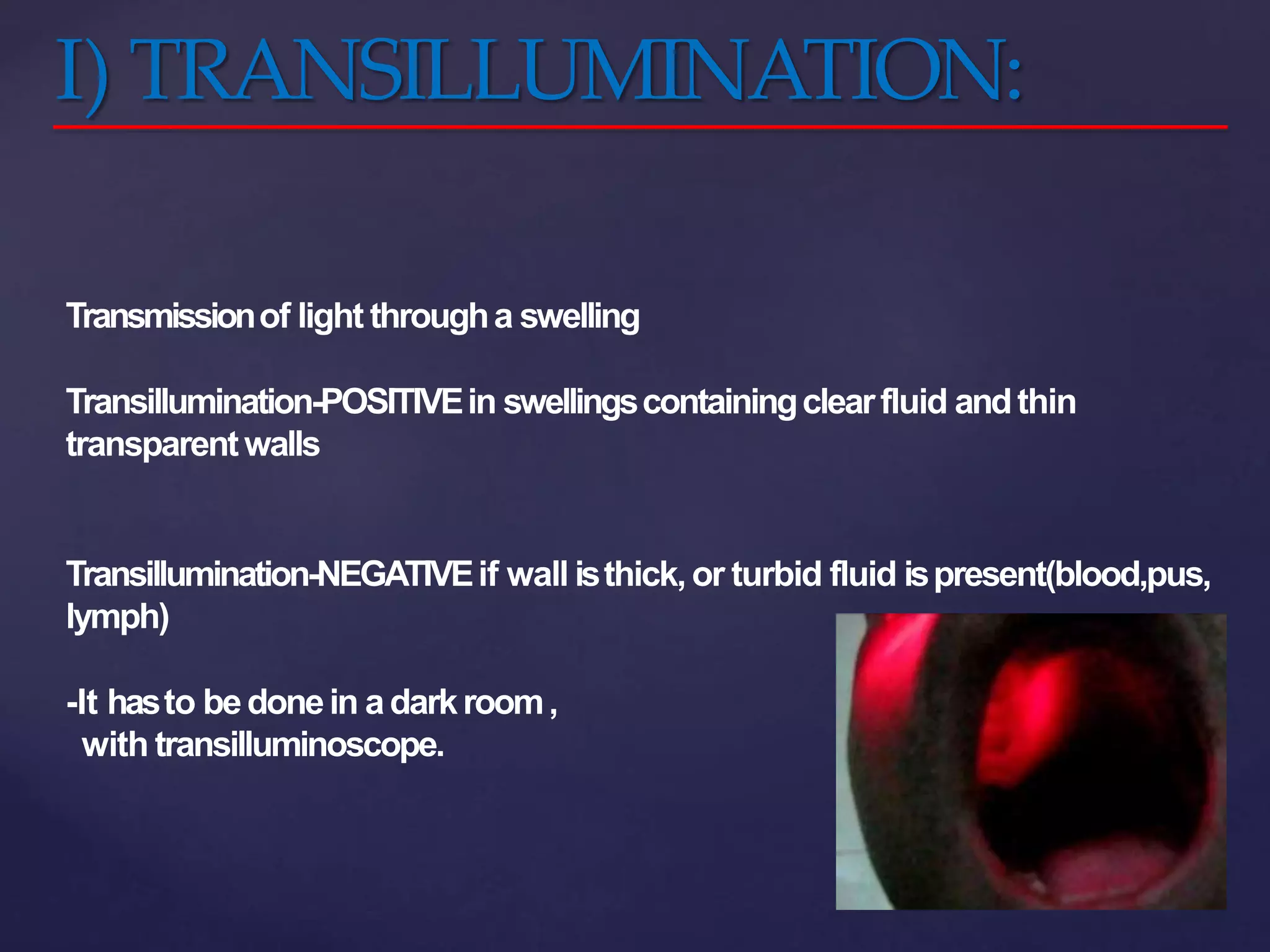 Examination of a swelling | PPTX