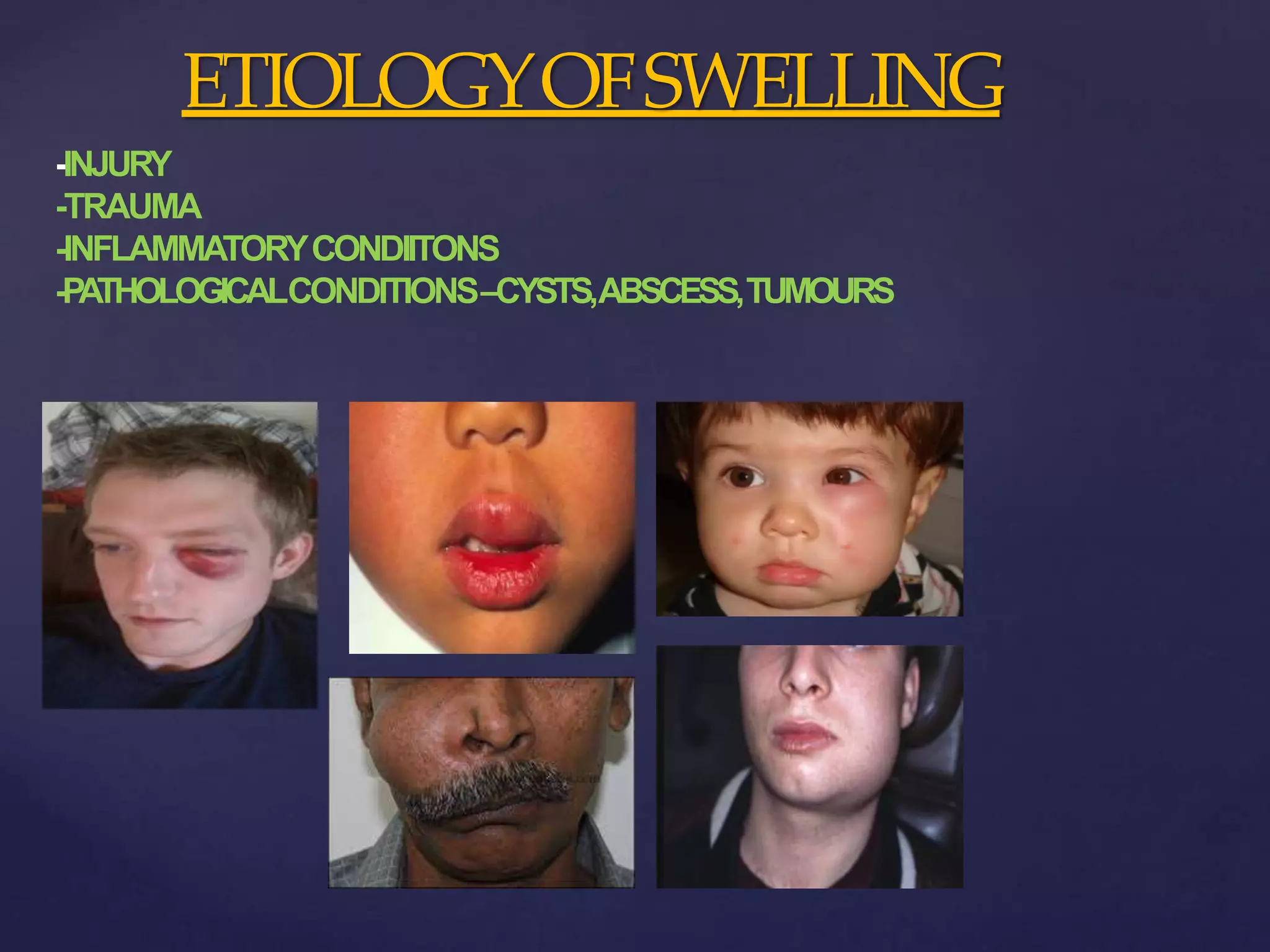 Examination of a swelling | PPTX