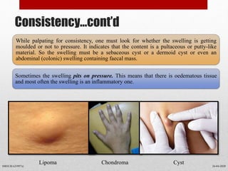 EXAMINATION OF SWELLING | PPTX