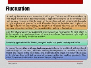 EXAMINATION OF SWELLING | PPTX