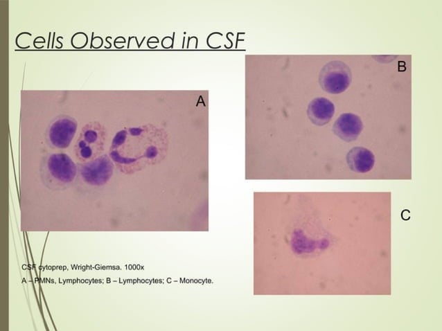 Examination of body cavity fluids (1).pptx