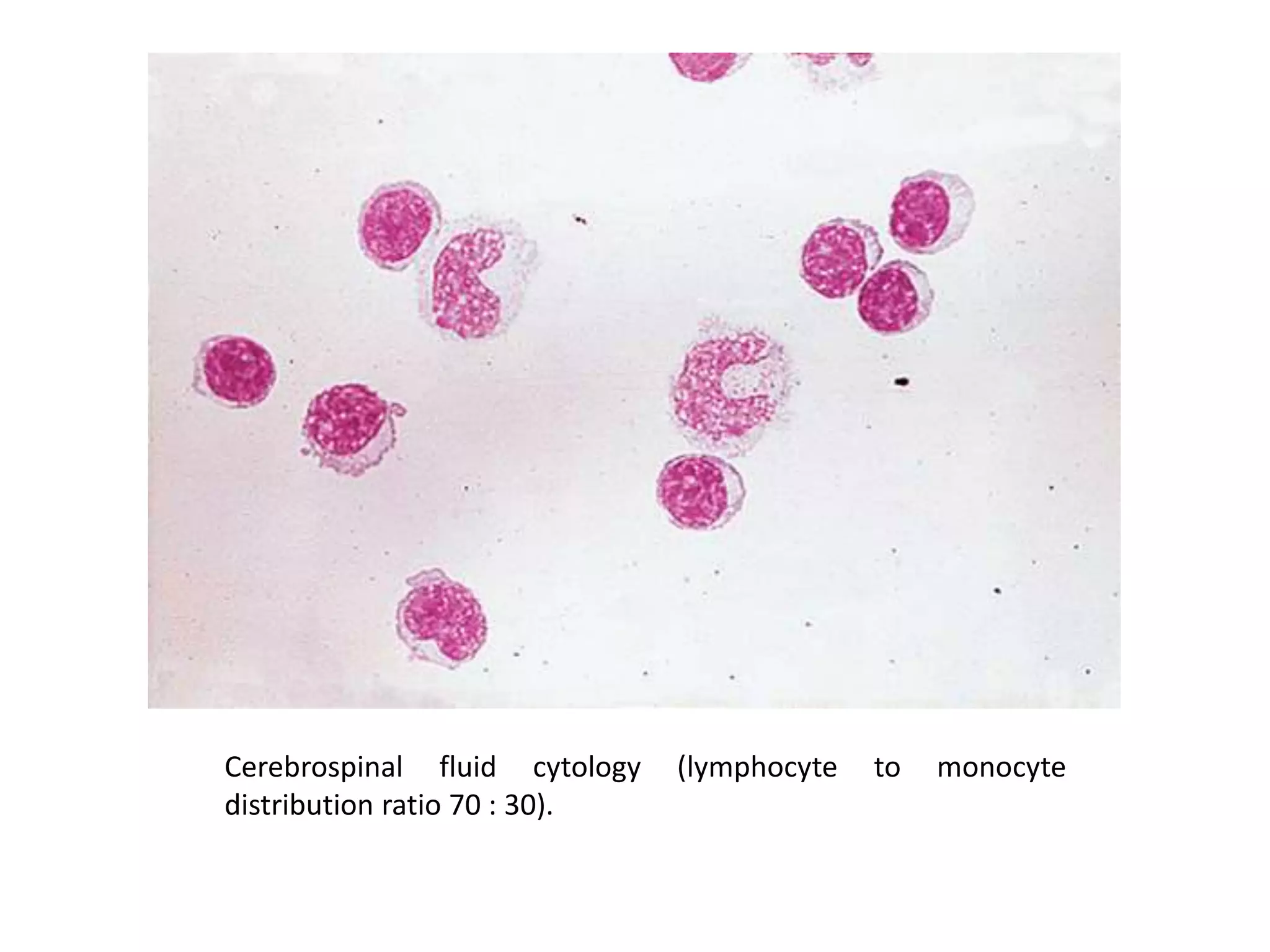 Pathological examination of body fluids | PPTX
