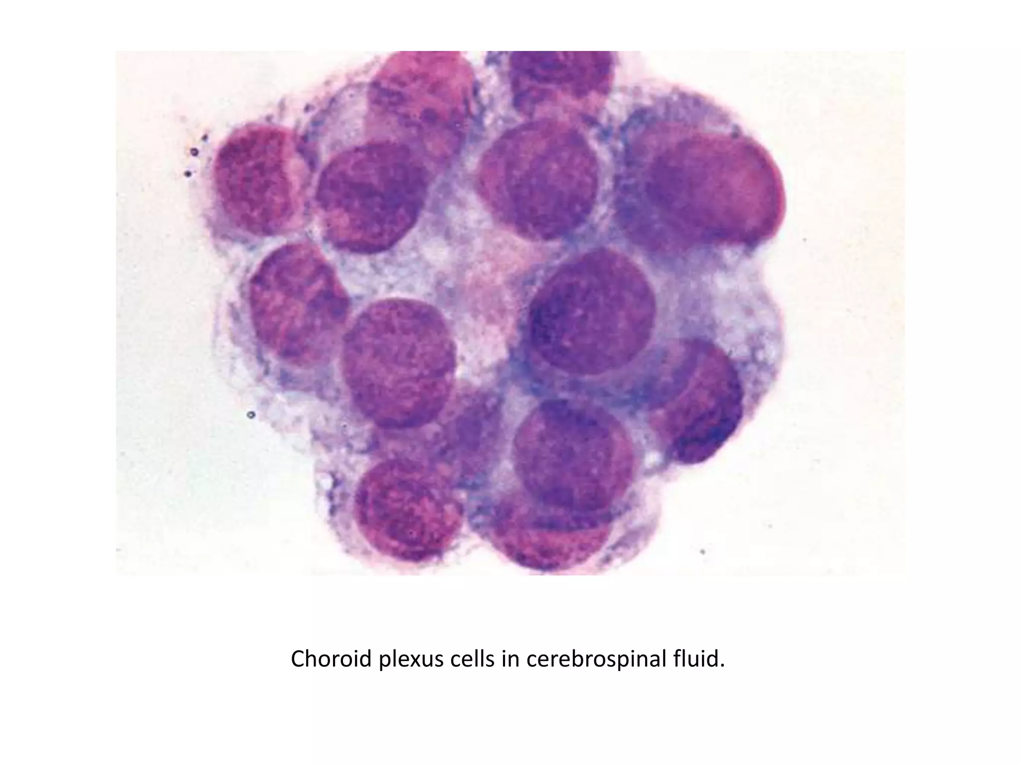 Pathological examination of body fluids | PPTX