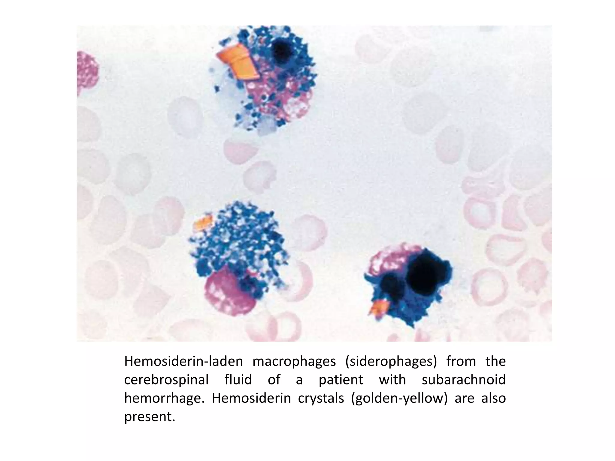 Pathological examination of body fluids | PPTX | Blood Disorders ...