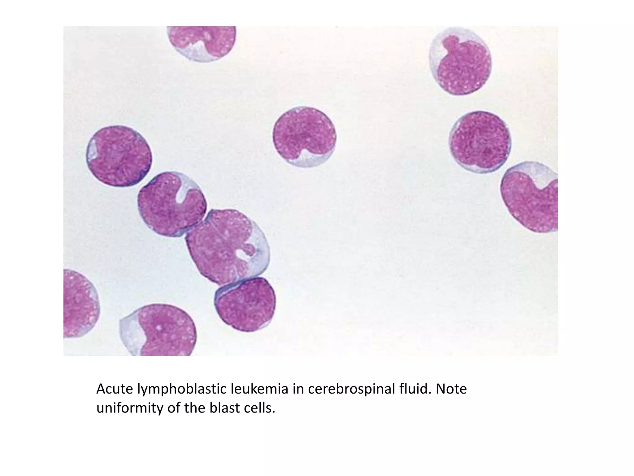 Pathological examination of body fluids | PPTX