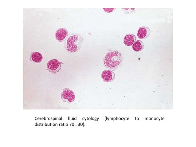 Pathological examination of body fluids | PPTX | Blood Disorders ...