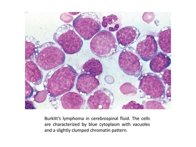 Pathological examination of body fluids | PPTX | Blood Disorders ...