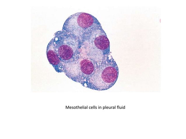 Pathological examination of body fluids | PPTX | Blood Disorders ...