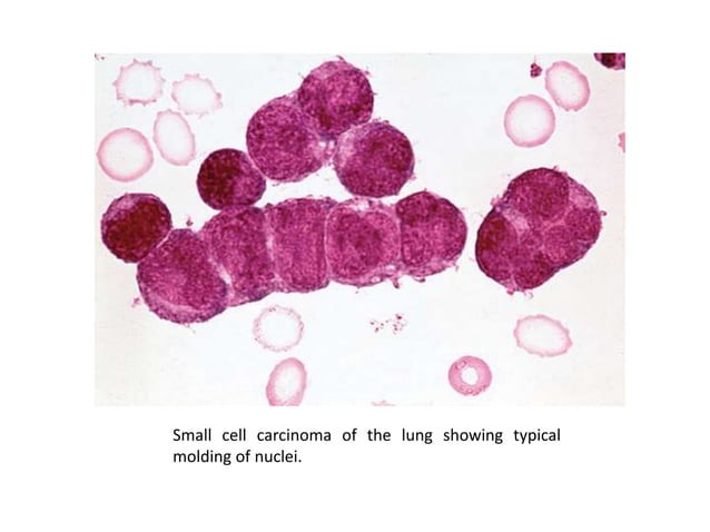 Pathological examination of body fluids | PPTX | Blood Disorders ...