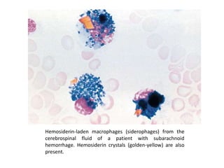 Pathological examination of body fluids | PPT