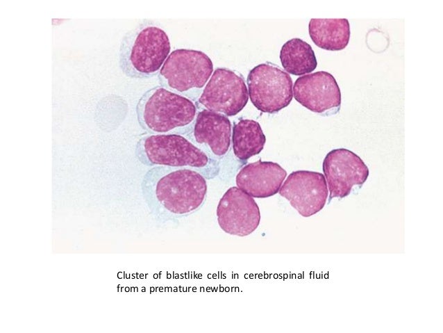 Pathological examination of body fluids