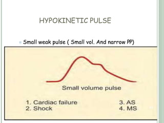 examinationofcardiovascularsystempediatrics-200510144322.pdf