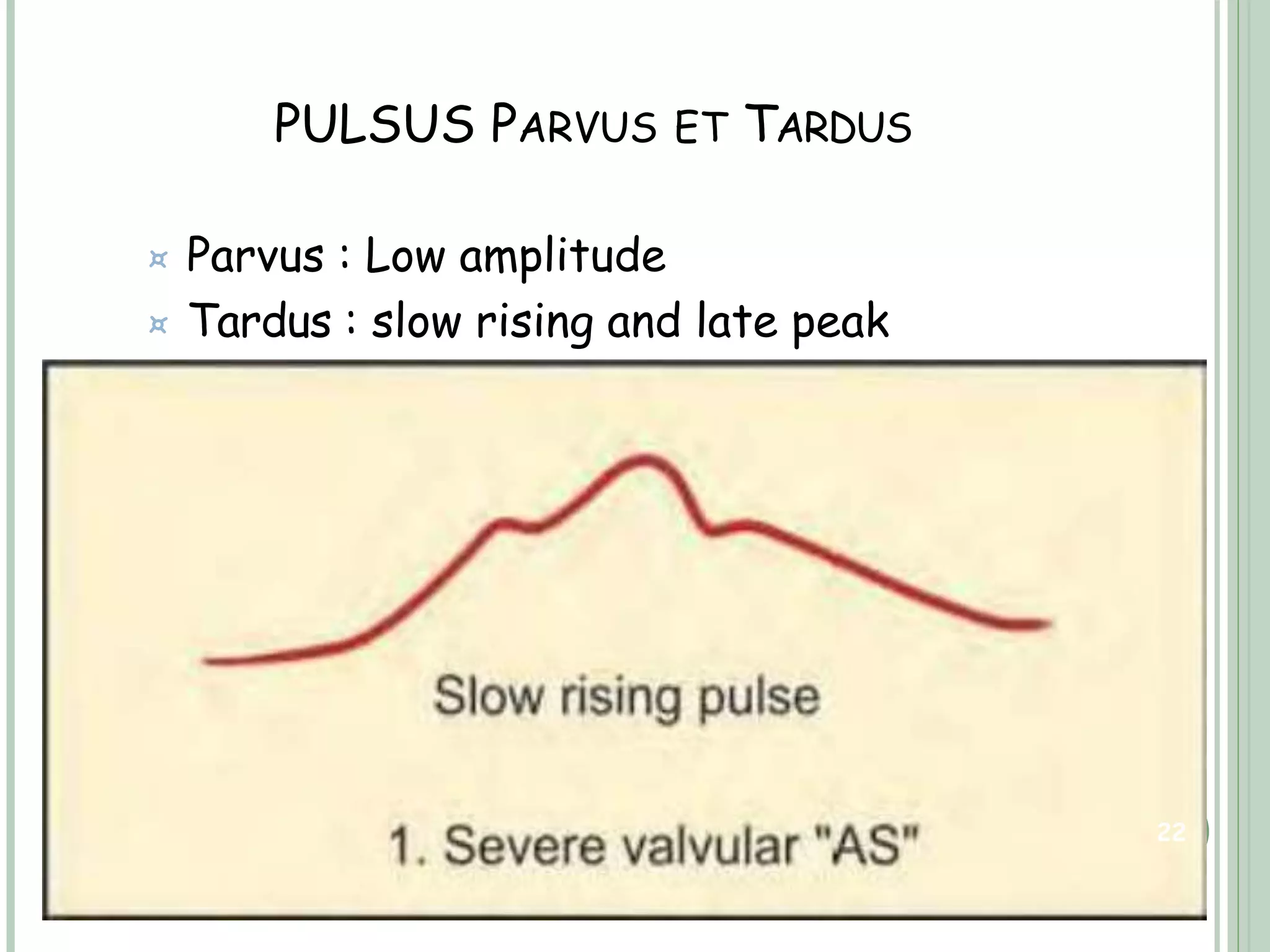 Examination of Cardio Vascular System (CVS): Pediatrics+ APPROACH TO A ...
