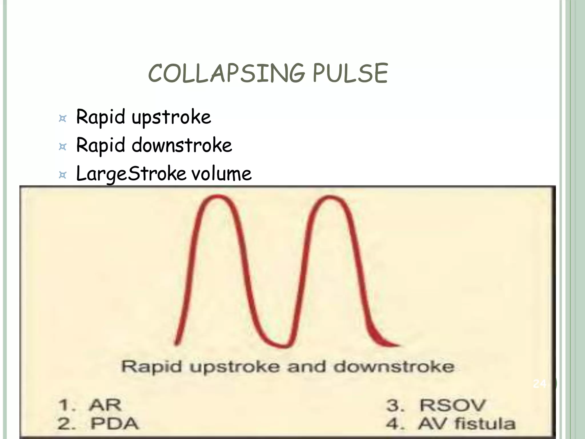 Examination of Cardio Vascular System (CVS): Pediatrics+ APPROACH TO A ...