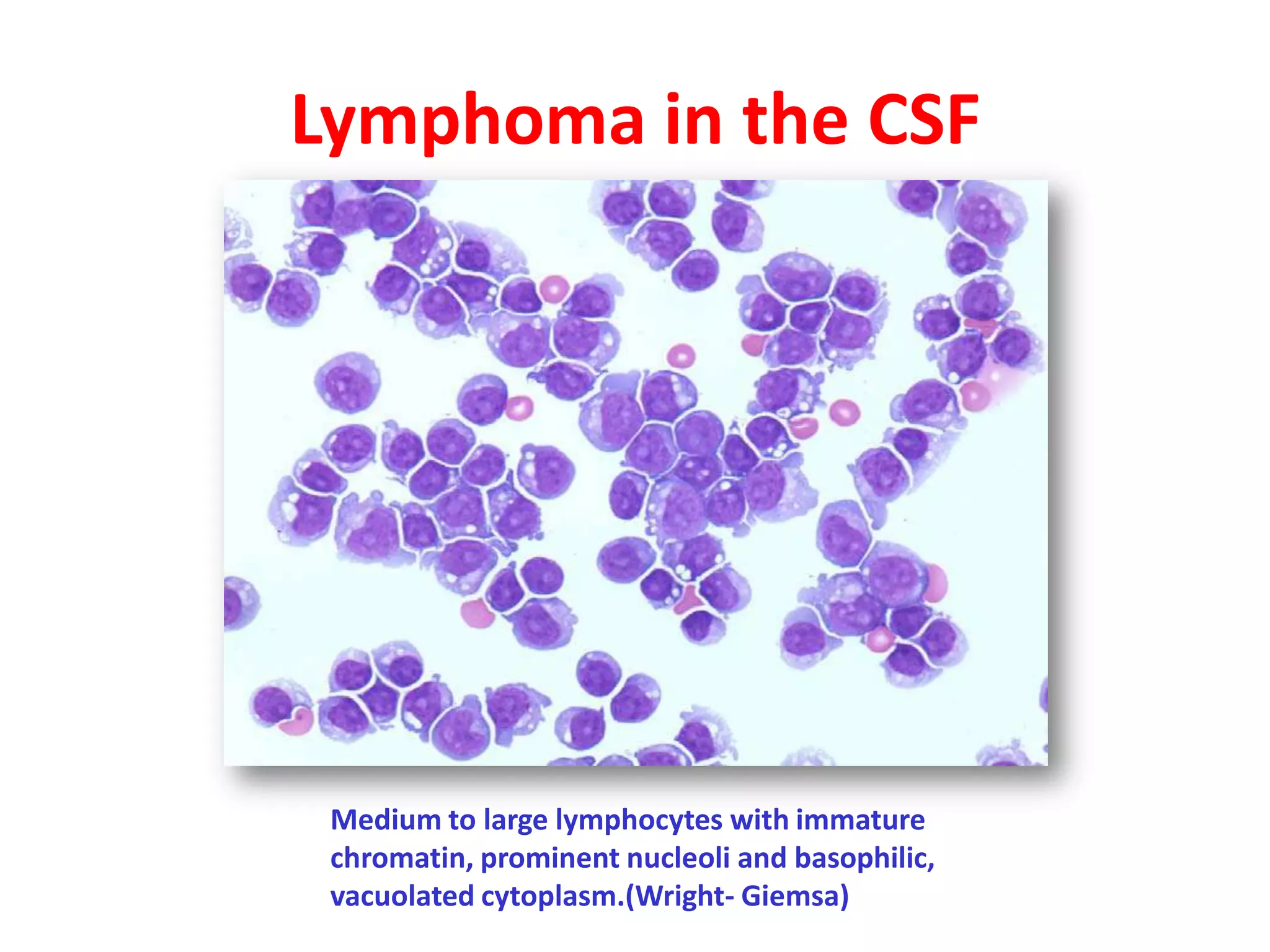 Examination of cerebrospinal fluid presentation mode | PPSX