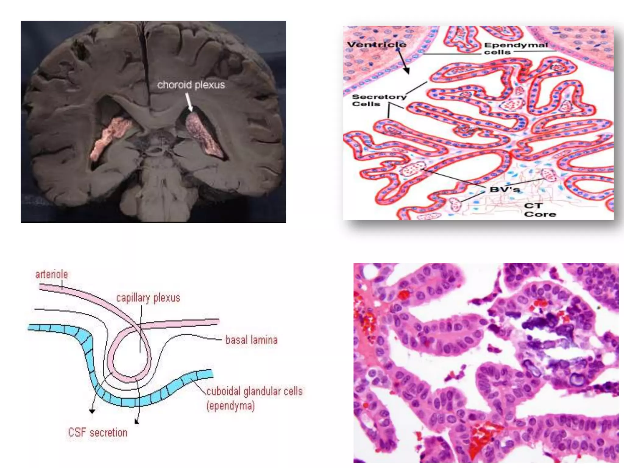 Examination of cerebrospinal fluid presentation mode | PPSX
