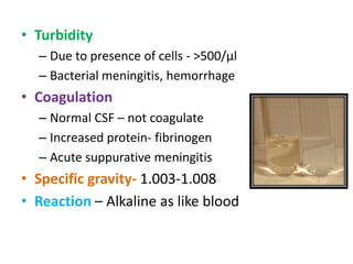 Examination of cerebrospinal fluid presentation mode | PPSX