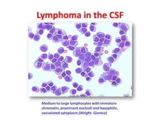 Examination of cerebrospinal fluid presentation mode | PPSX