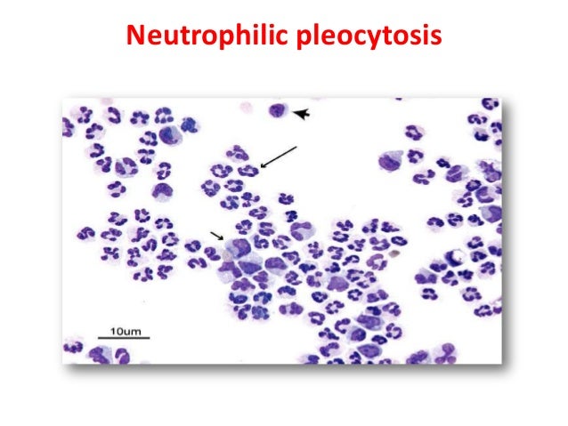 Examination of cerebrospinal fluid presentation mode