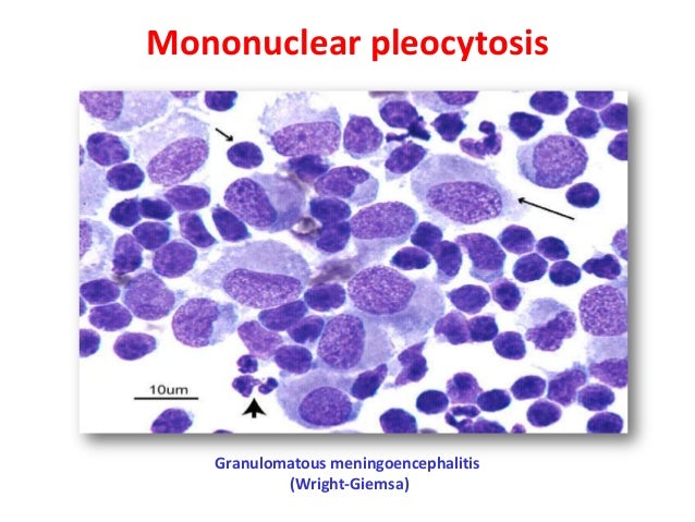 Examination of cerebrospinal fluid presentation mode