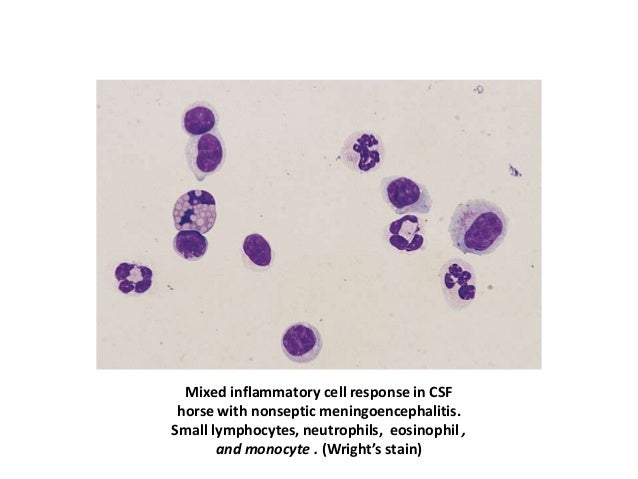 Examination of cerebrospinal fluid presentation mode