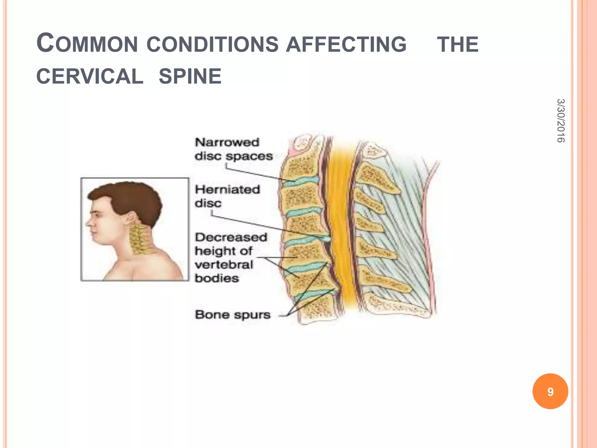 Examination of cervical disorder | PPTX