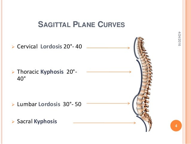 Sacral Kyphosis