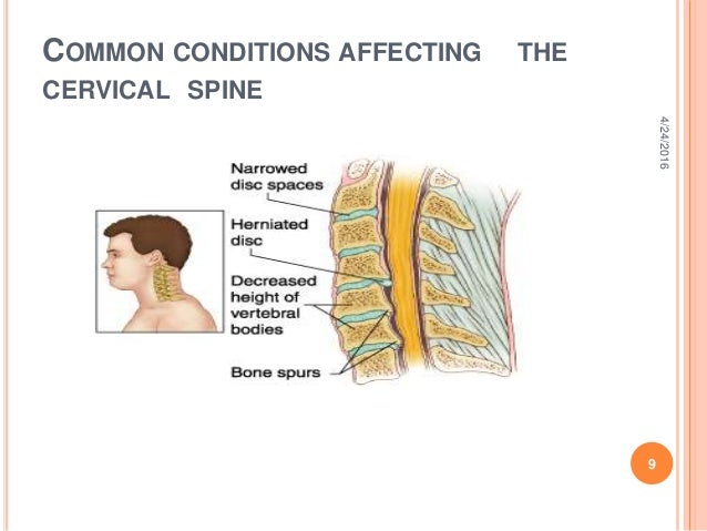 Examination of cervical disorder