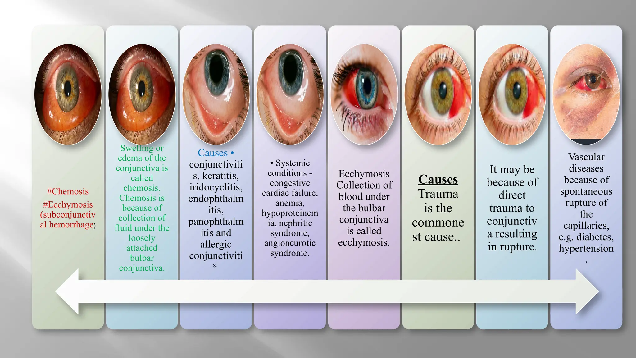 Examination of Conjunctiva.Abnormalities .pptx