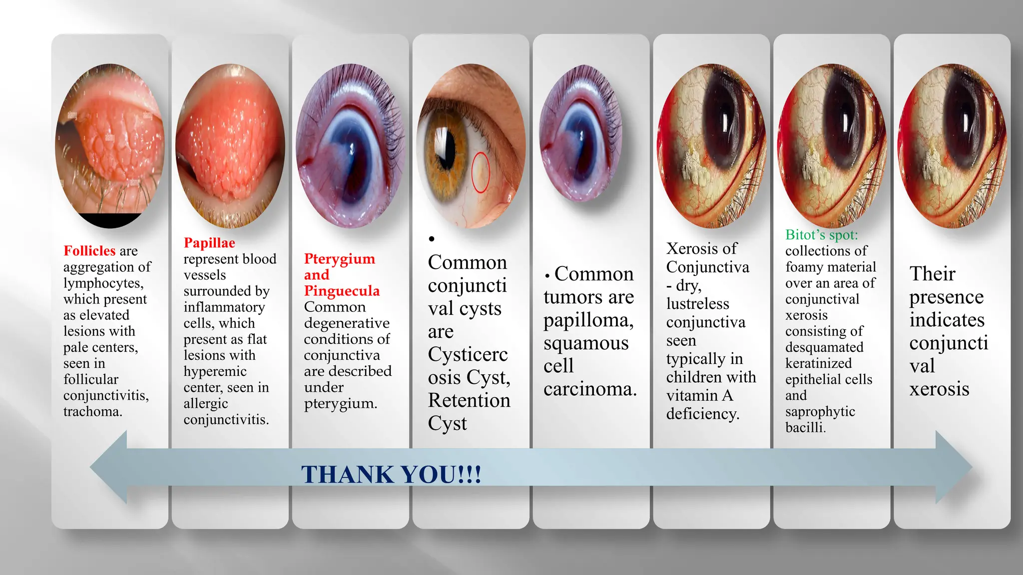 Examination of Conjunctiva.Abnormalities .pptx