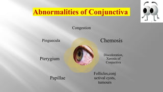 Examination of Conjunctiva.Abnormalities .pptx