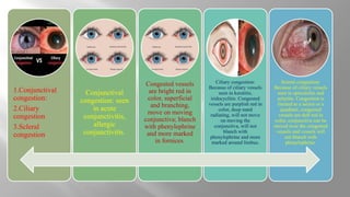 Examination of Conjunctiva.Abnormalities .pptx
