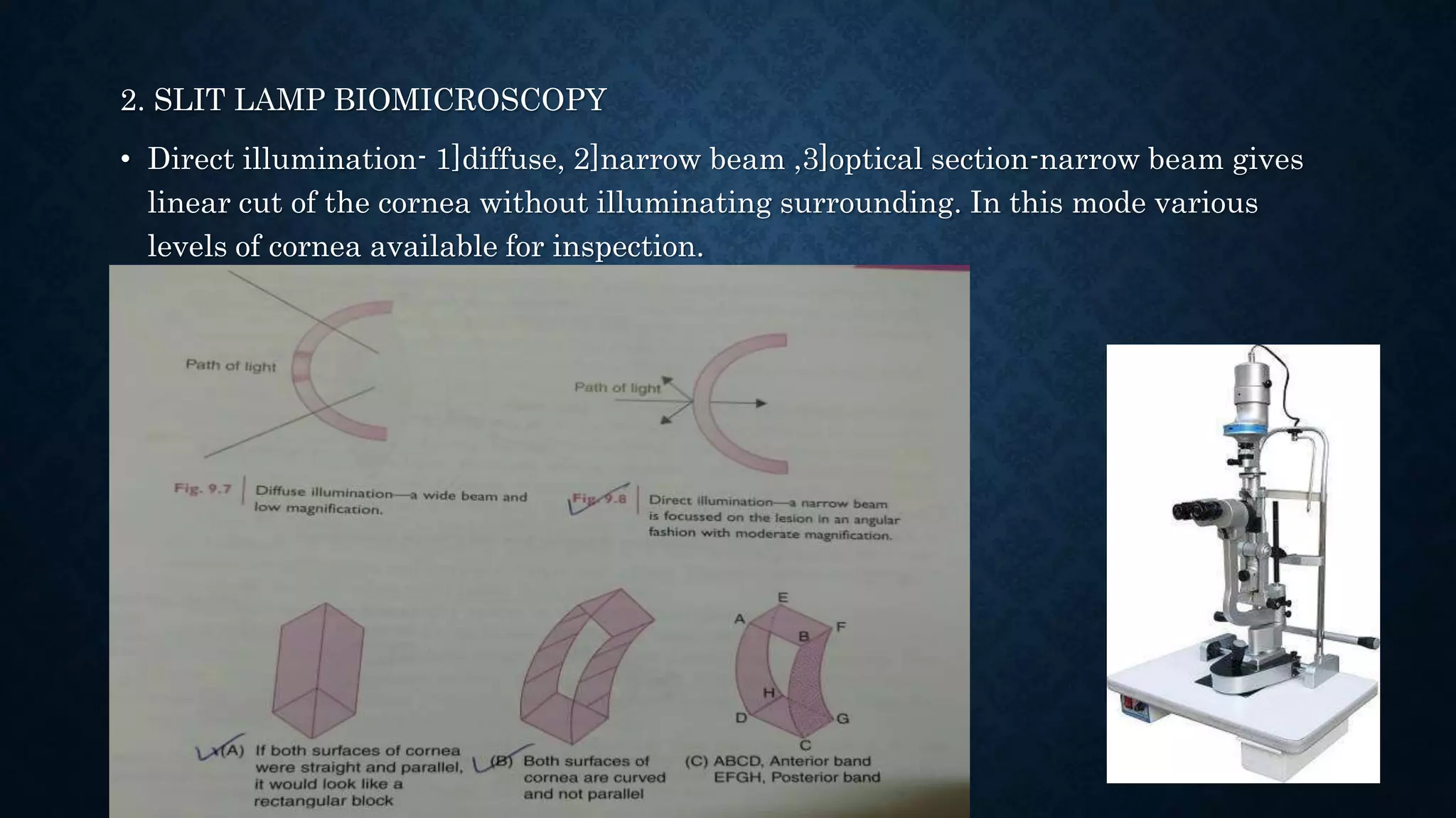Examination of cornea | PPTX
