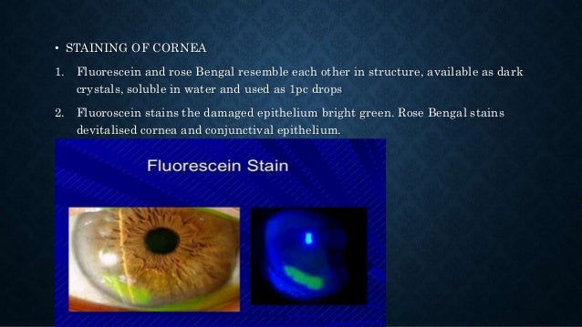 Examination of cornea