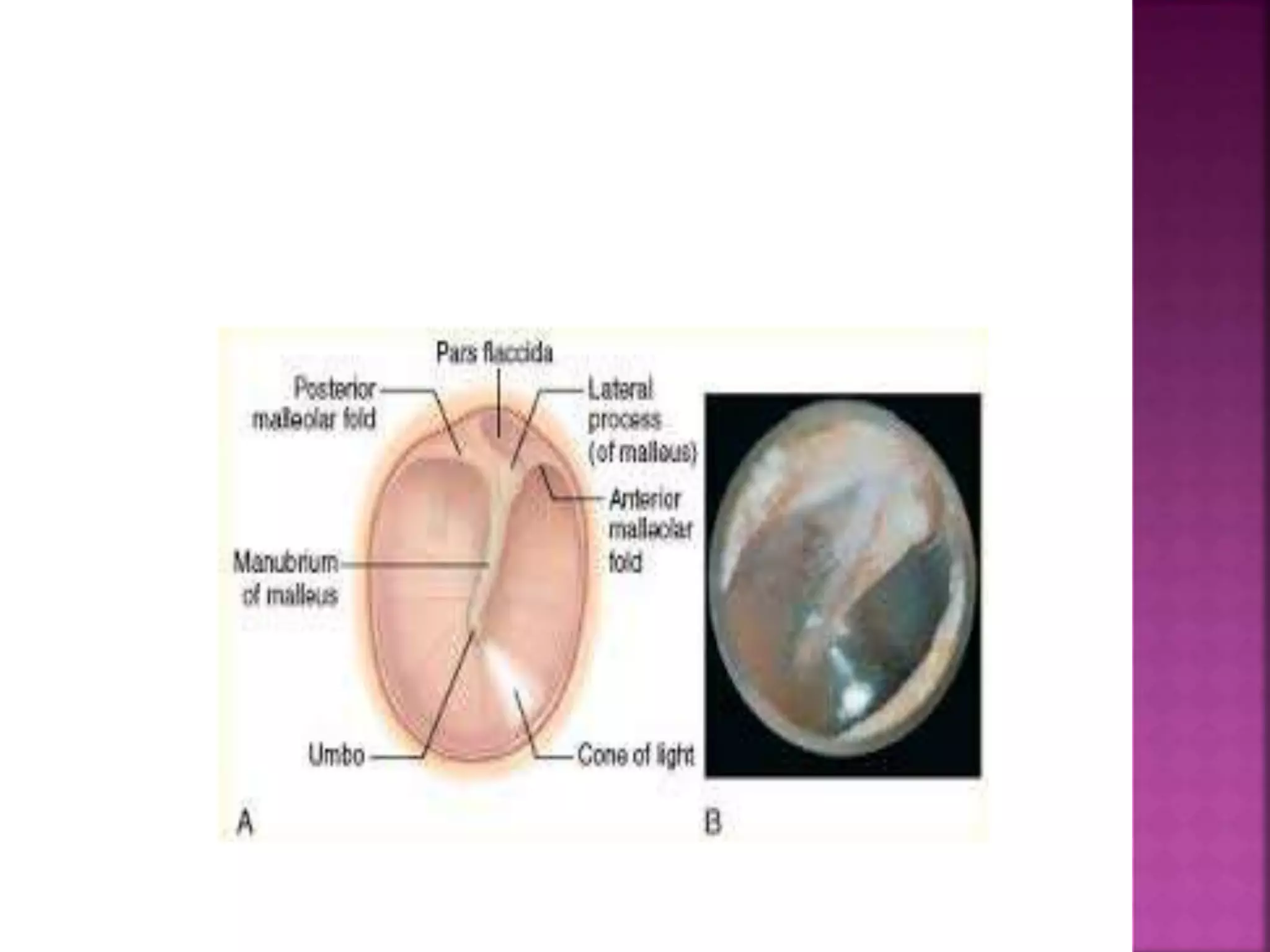 Examination of ear | PPTX