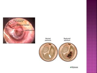 Examination of ear | PPTX