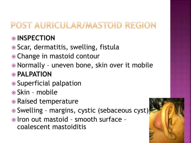 Examination of ear | PPT