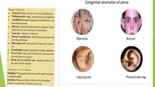Examination of ear. | PPTX