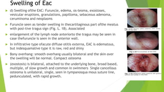 Examination of ear. | PPTX