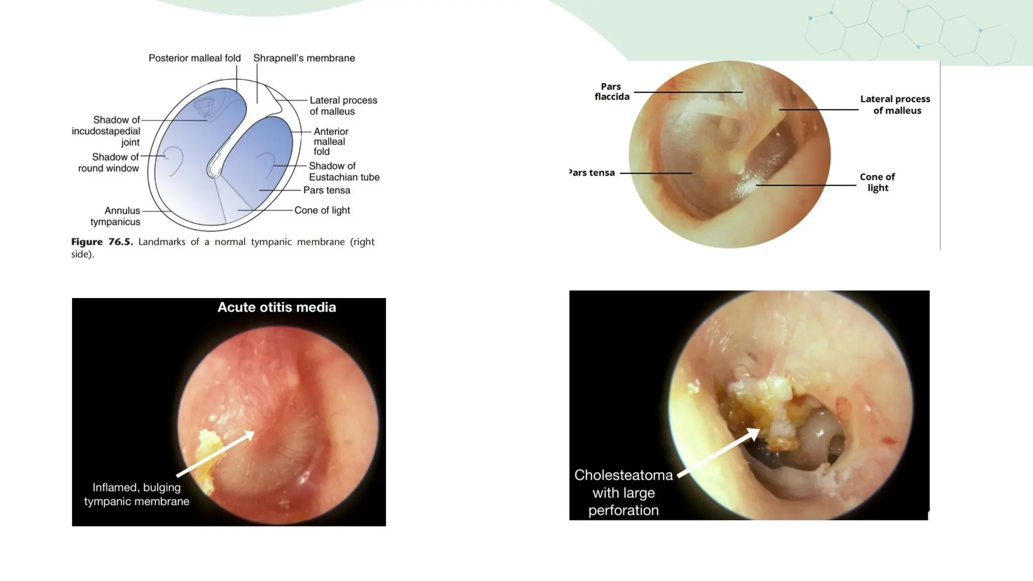 EXAMINATION OF EAR .pptx.pptxuyyyytgggyfff | PPTX