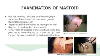 EXAMINATION OF EAR .pptx.pptxuyyyytgggyfff | PPTX