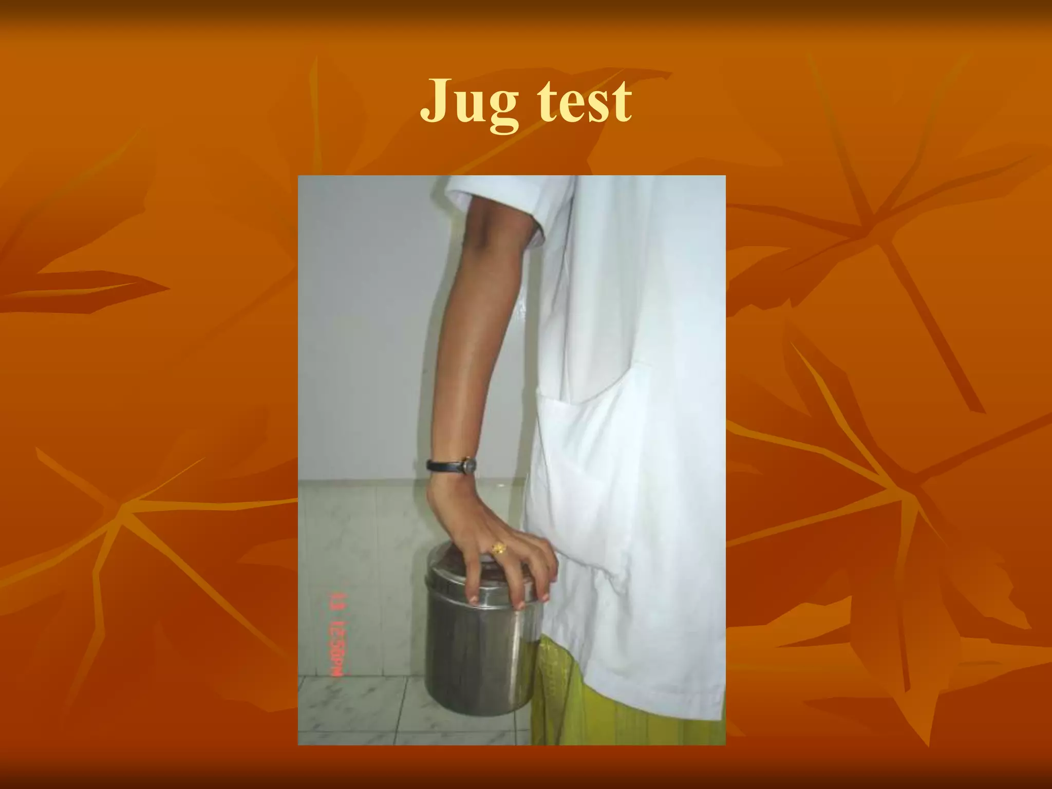 Examination of elbow | PPT
